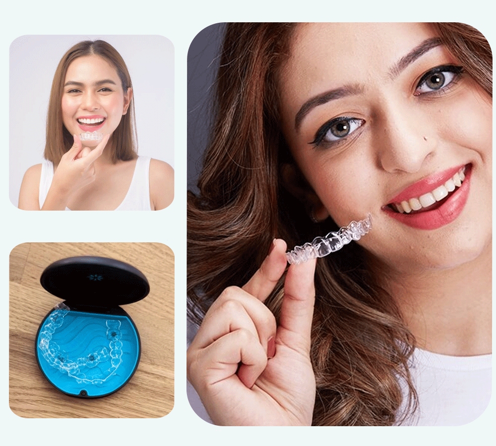 Invisalign Offer - The Dental Studio